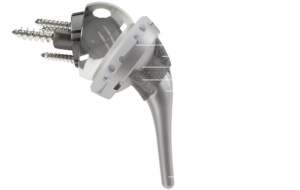 InSet™ Reverse Total Shoulder System - Shoulder Innovations